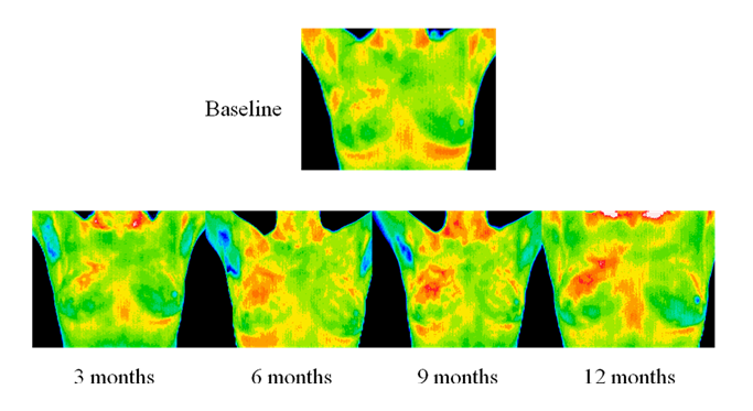 Risk Assessment – PHS New